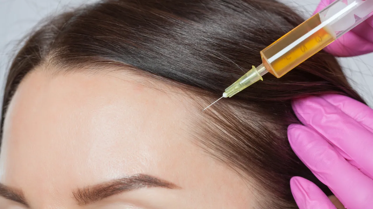 Black Spots On Bald Head Causes And Solutions Black Spots On Bald Head Causes And Solutions