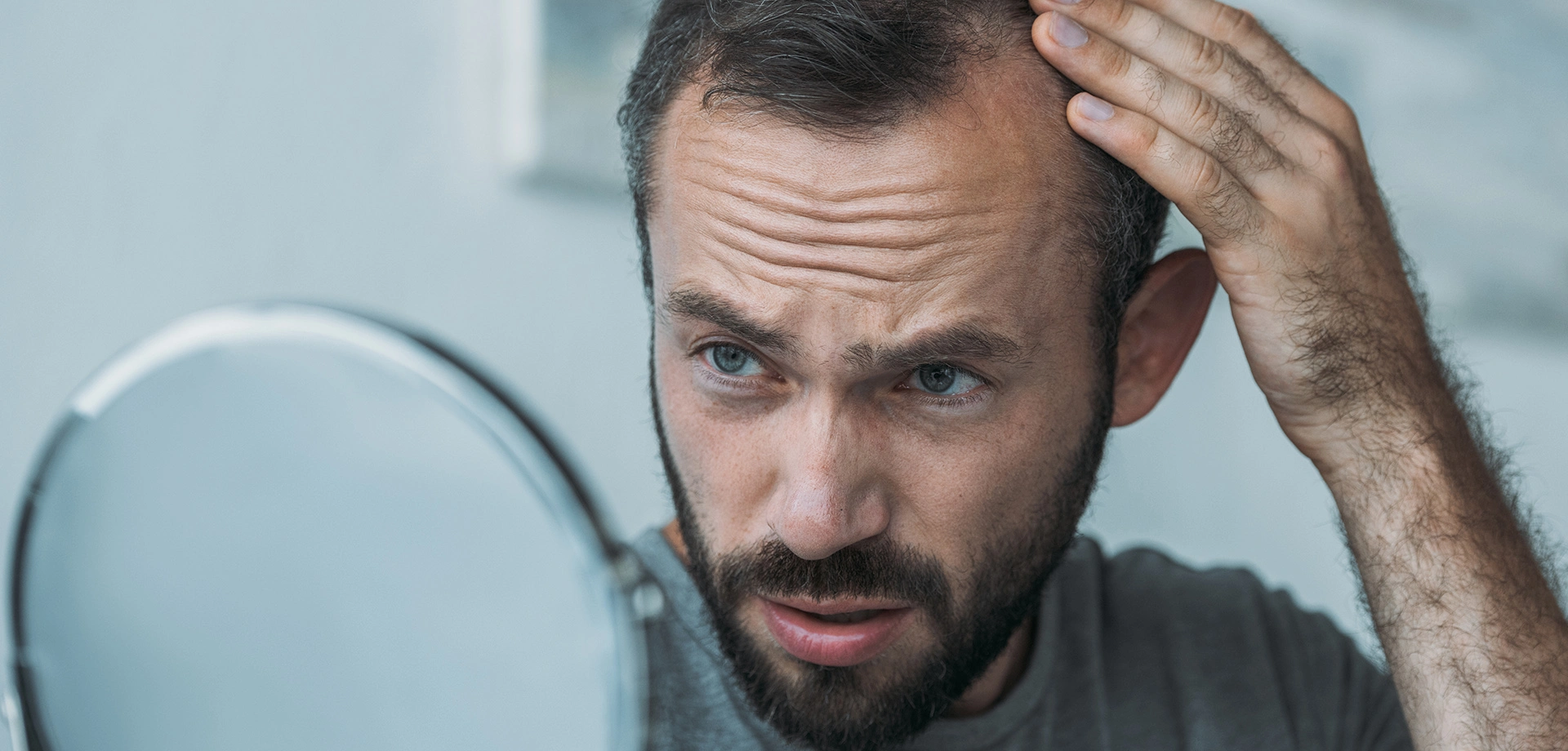 Balding From One Side: Causes, Tests, Treatments