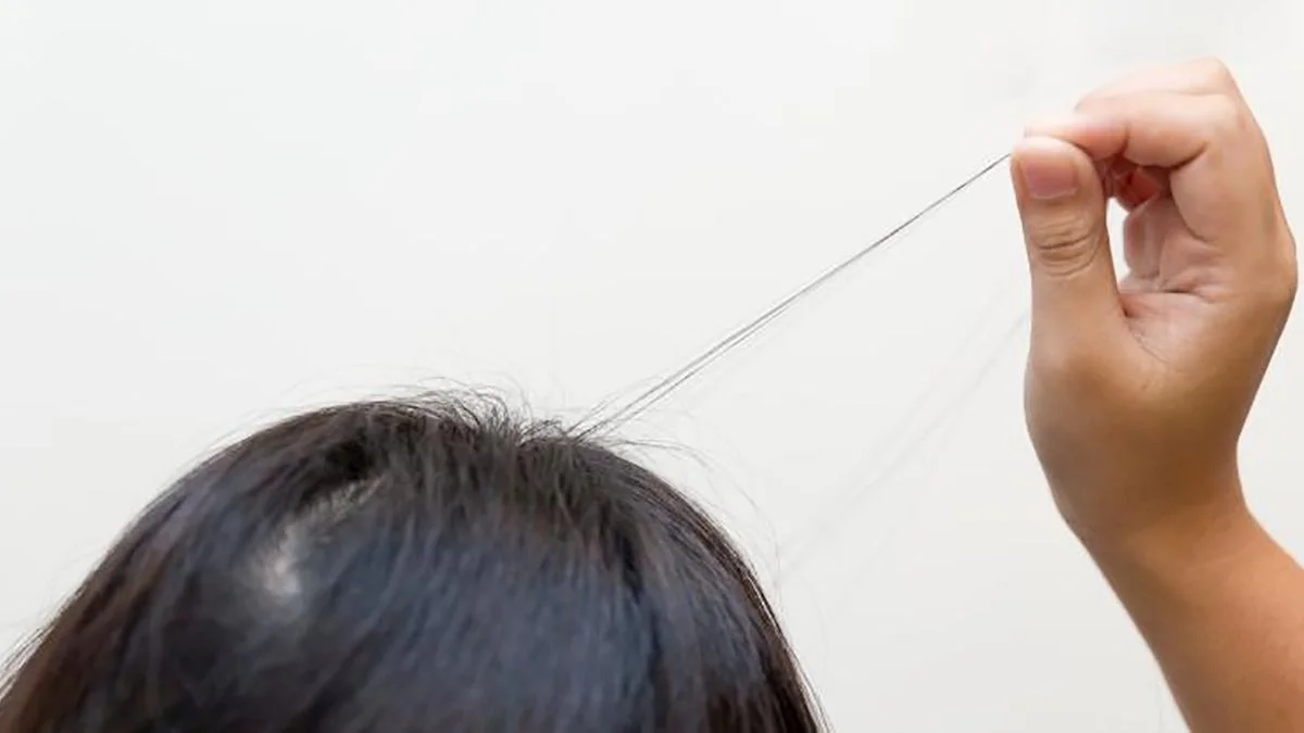 Stress Alopecia Treatment – Regrow Hair and Restore Confidence