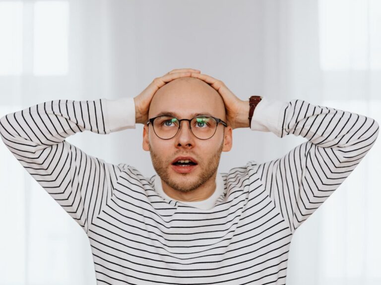 Will I Go Bald? Early Signs and What They Mean - Kopelman Hair